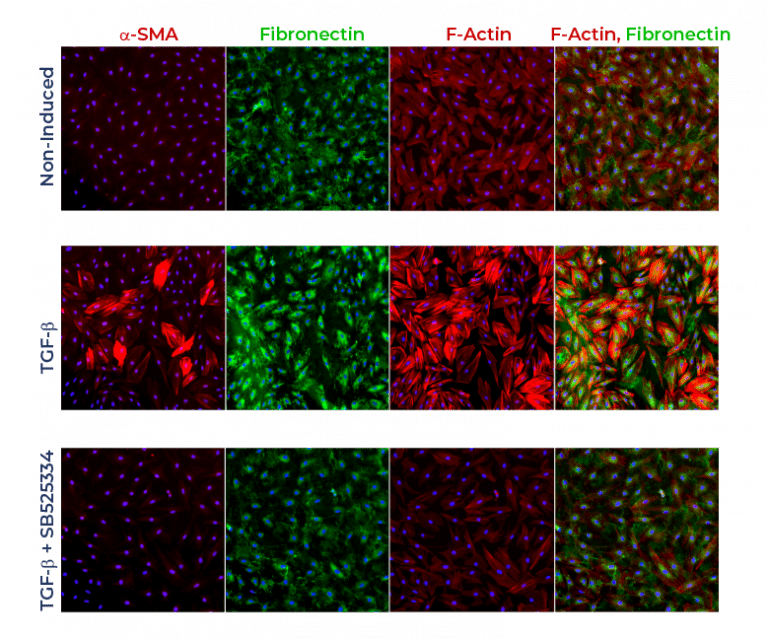 In Vitro Assay Developments for Fibrosis Research at Sygnature