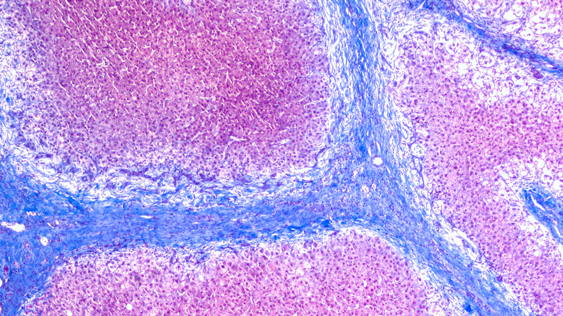 Fibrosis and Inflammation models - Sygnature Discovery