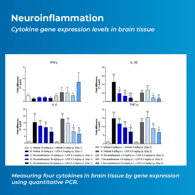 Unravelling Neuroinflammation: Brain's Immune Response