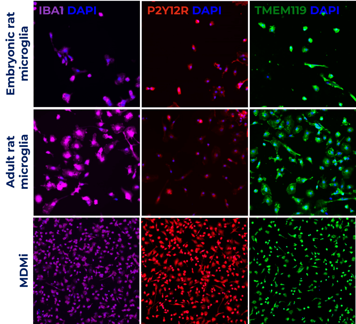Targeting Neuroinflammation | Sygnature Discovery